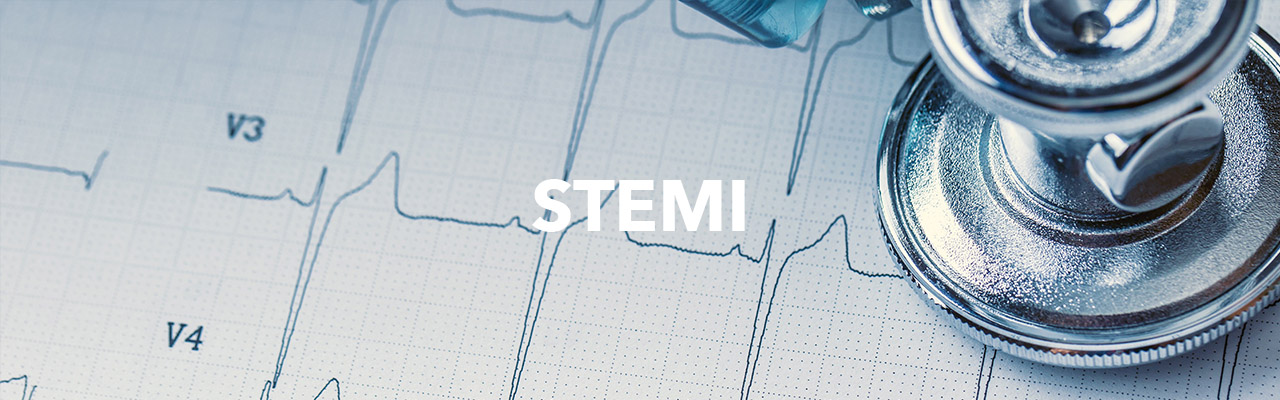 STEMI Protocols and Criteria – Louisiana Emergency Response Network